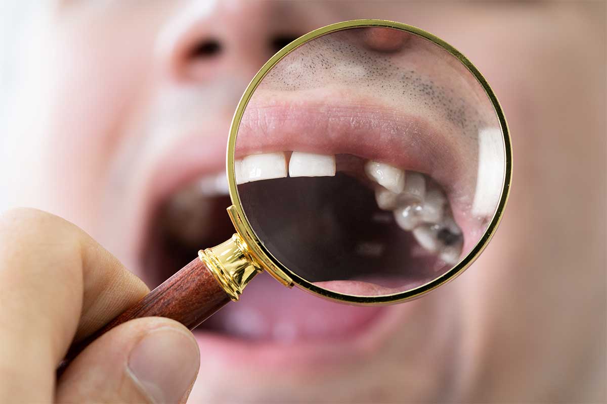 Tooth Replacement Without Implants: What Are Your Options? | Radiance ...
